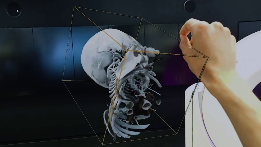 Virtual Cinematic Reality for medical education – Cinematic Rendering ...