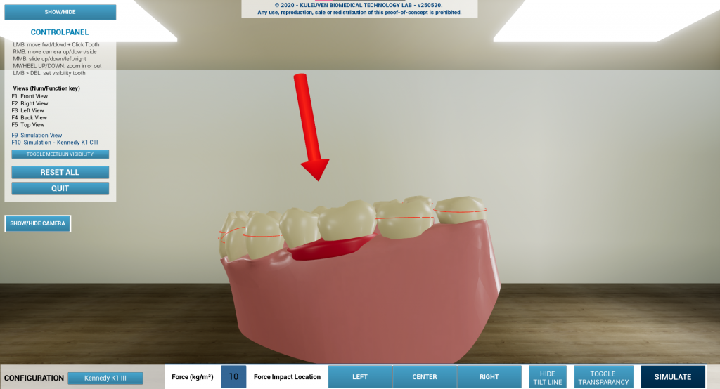 Dental Prosthesis Simulator - Media and Learning