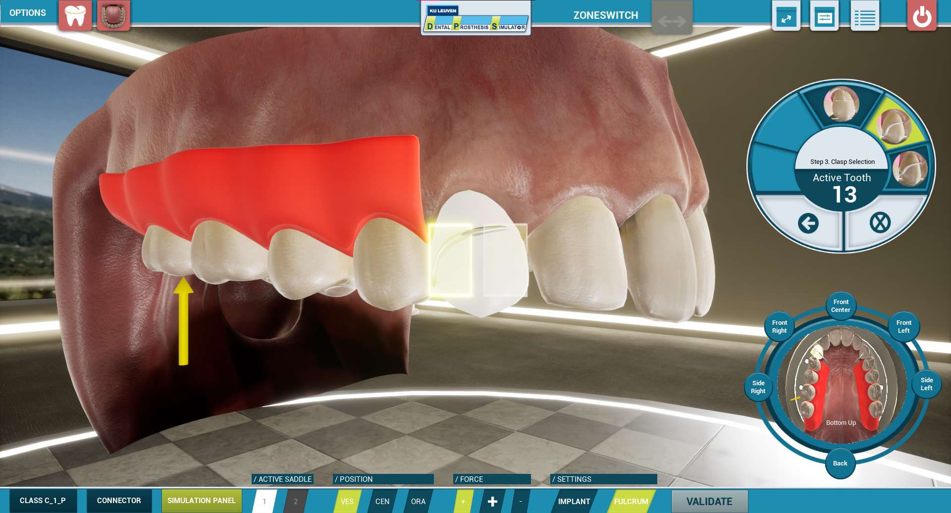 Dental Prosthesis Simulator - Media and Learning
